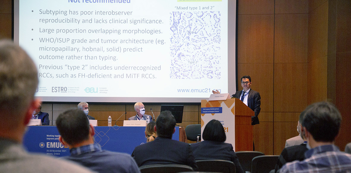 Expectations for new WHO classification and what’s next in PCa grading ...